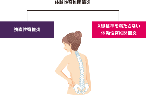 体軸性脊椎関節炎について 体軸性脊椎関節炎（強直性脊椎炎、x線基準を満たさない体軸性脊椎関節炎）の患者さん向け コセンティクス®を使用