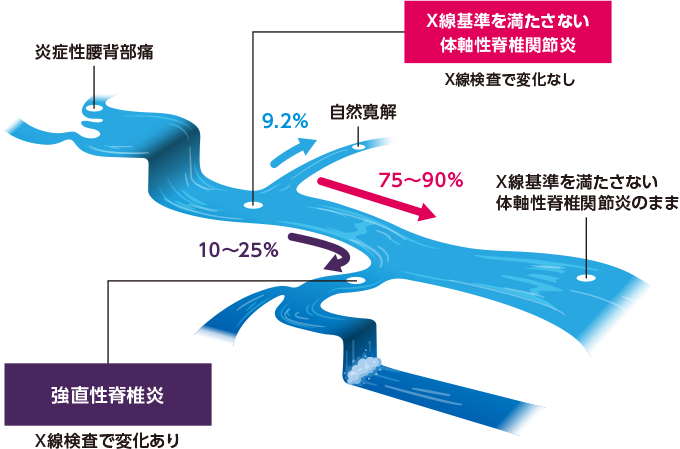 体軸性脊椎関節炎について 体軸性脊椎関節炎（強直性脊椎炎、x線基準を満たさない体軸性脊椎関節炎）の患者さん向け コセンティクス®を使用